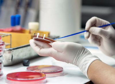 AMR and Associated Risk Factors of Gram-Negative Bacterial Bloodstream ...