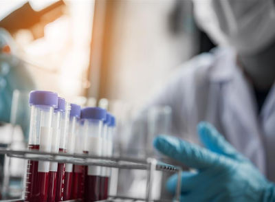 Nailing The Culprit Quickly: Syndromic Testing For Bloodstream ...