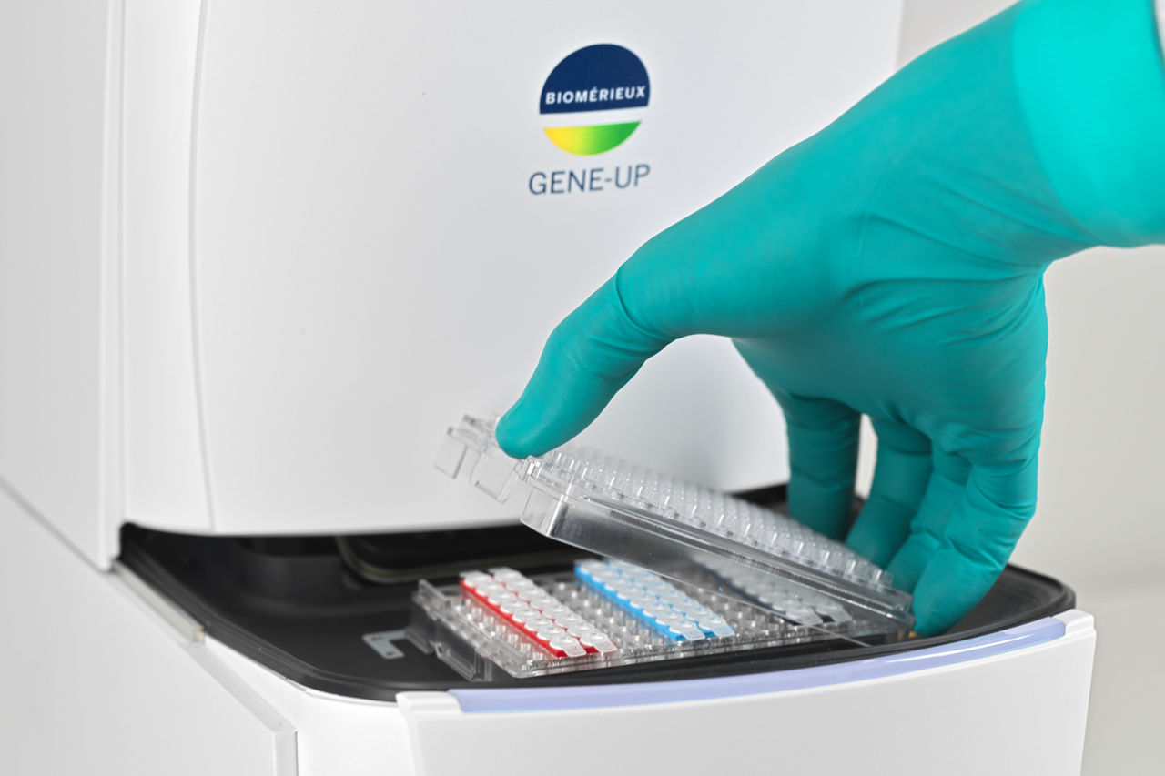 bioMérieux lance GENE-UP® TYPER, une solution diagnostique innovante destinée aux industries ...