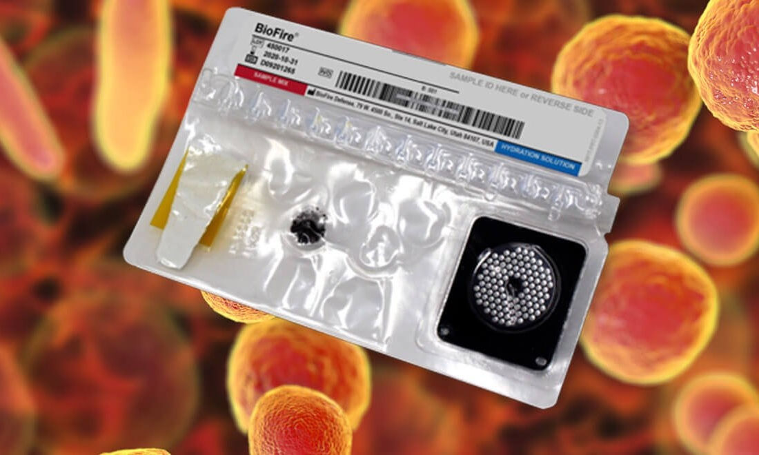 Automated 1 Hour Mycoplasma Testing in Bioproduction | Pioneering ...