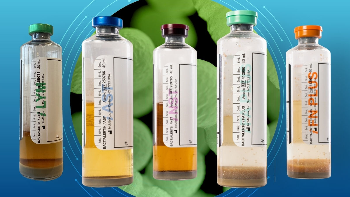 BACT/ALERT® Culture Media Bottles | Pioneering Diagnostics