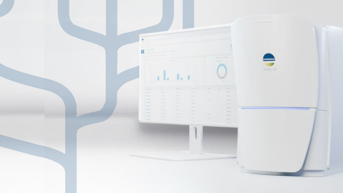 GENE-UP® TYPER | Pioneering Diagnostics