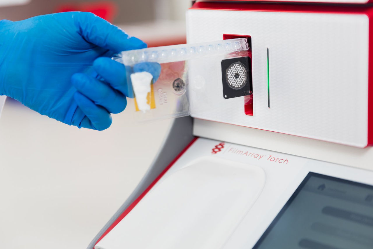 Meningitis: Fast Diagnostics for a Deadly Disease | bioMérieux