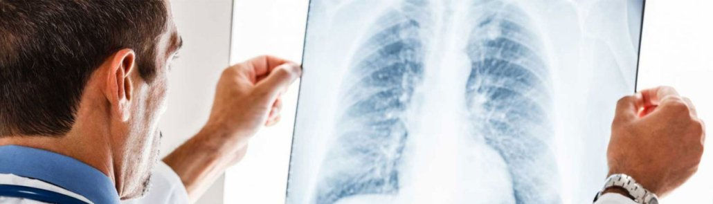 Rapid PCR for Pneumonia Pathogen Identification | bioMérieux