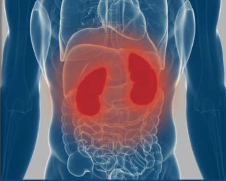 What is Sepsis-Associated Acute Kidney Injury? | bioMérieux