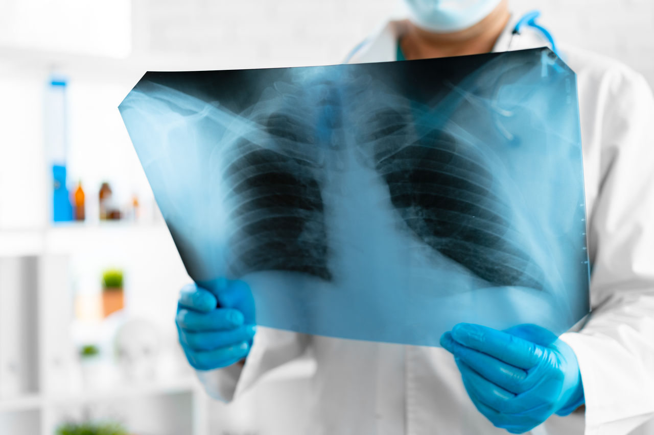 How The Flu Can Lead to Pneumonia? | bioMérieux Living Diagnostics Blog