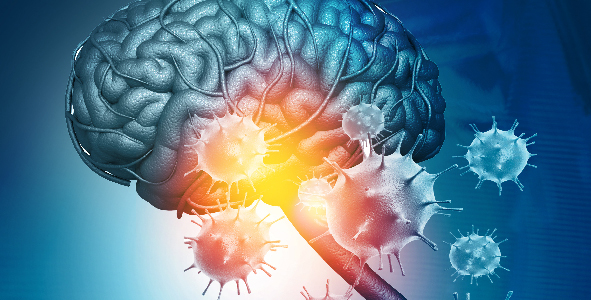 Meningitis: Deadly, Debilitating, and Associated With COVID-19 ...