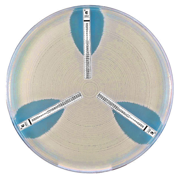 Etest Epsilometer Test Principle Purpose Procedure Pin By Shay Fojtik