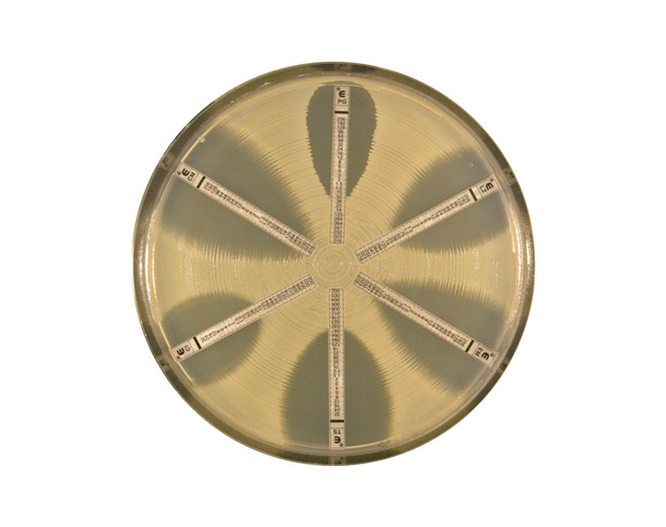 ETEST® | Pioneering Diagnostics