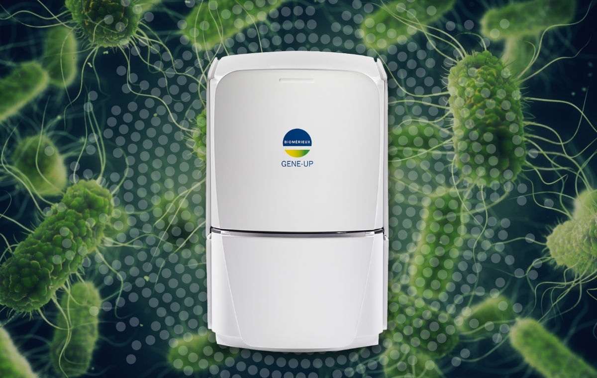 GENE-UP® PRO STEC / Salmonella | Pioneering Diagnostics