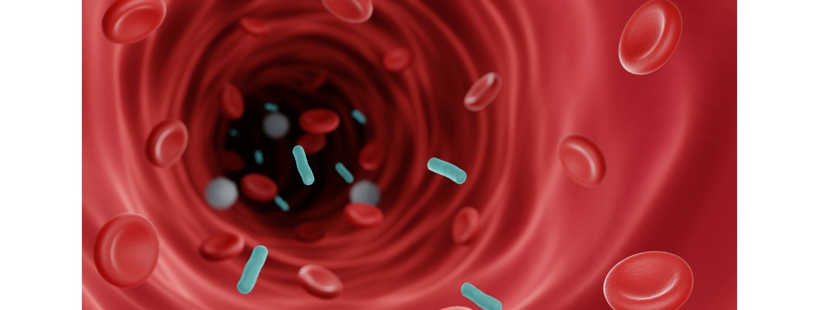 LL Editorial: Sepsis Care Diminished by Antimicrobial Resistance ...