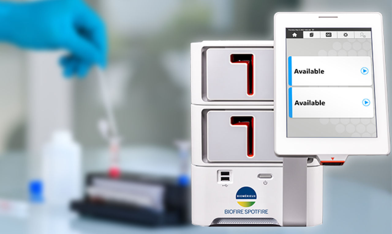 Adopt Revolutionary Mycoplasma Testing with Next Gen PCR to Reduce the ...