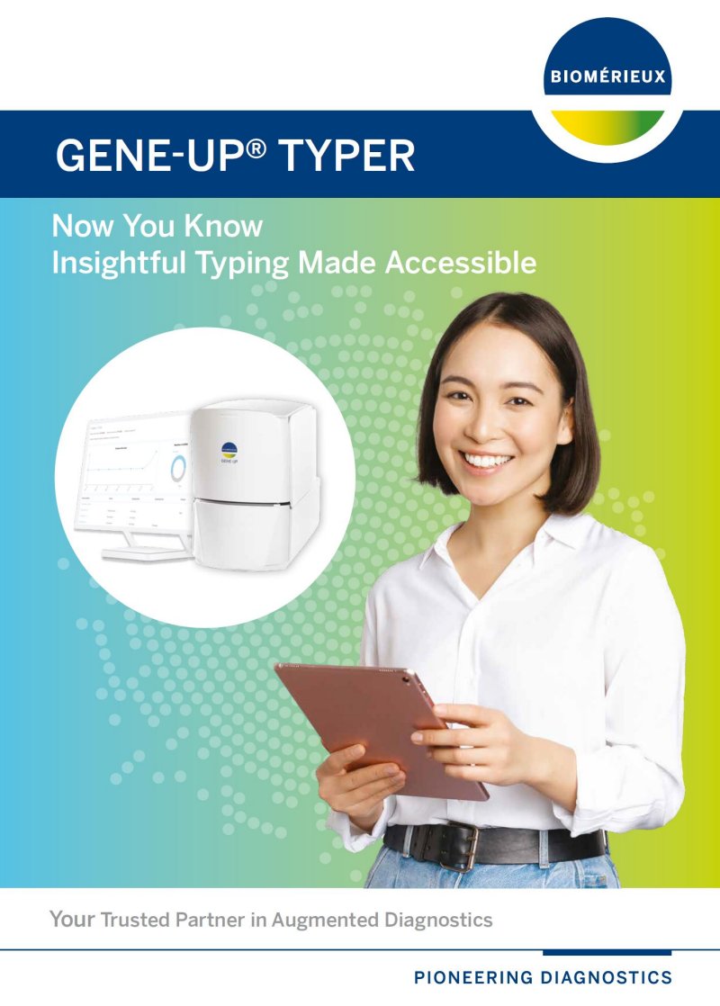GENE-UP® TYPER | Pioneering Diagnostics