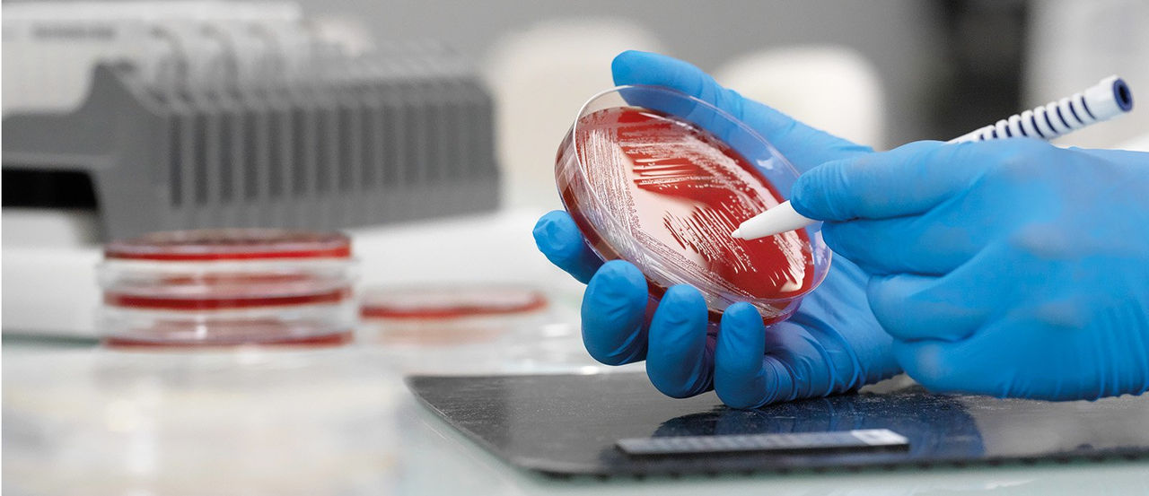 Microbial Identification | Pioneering Diagnostics